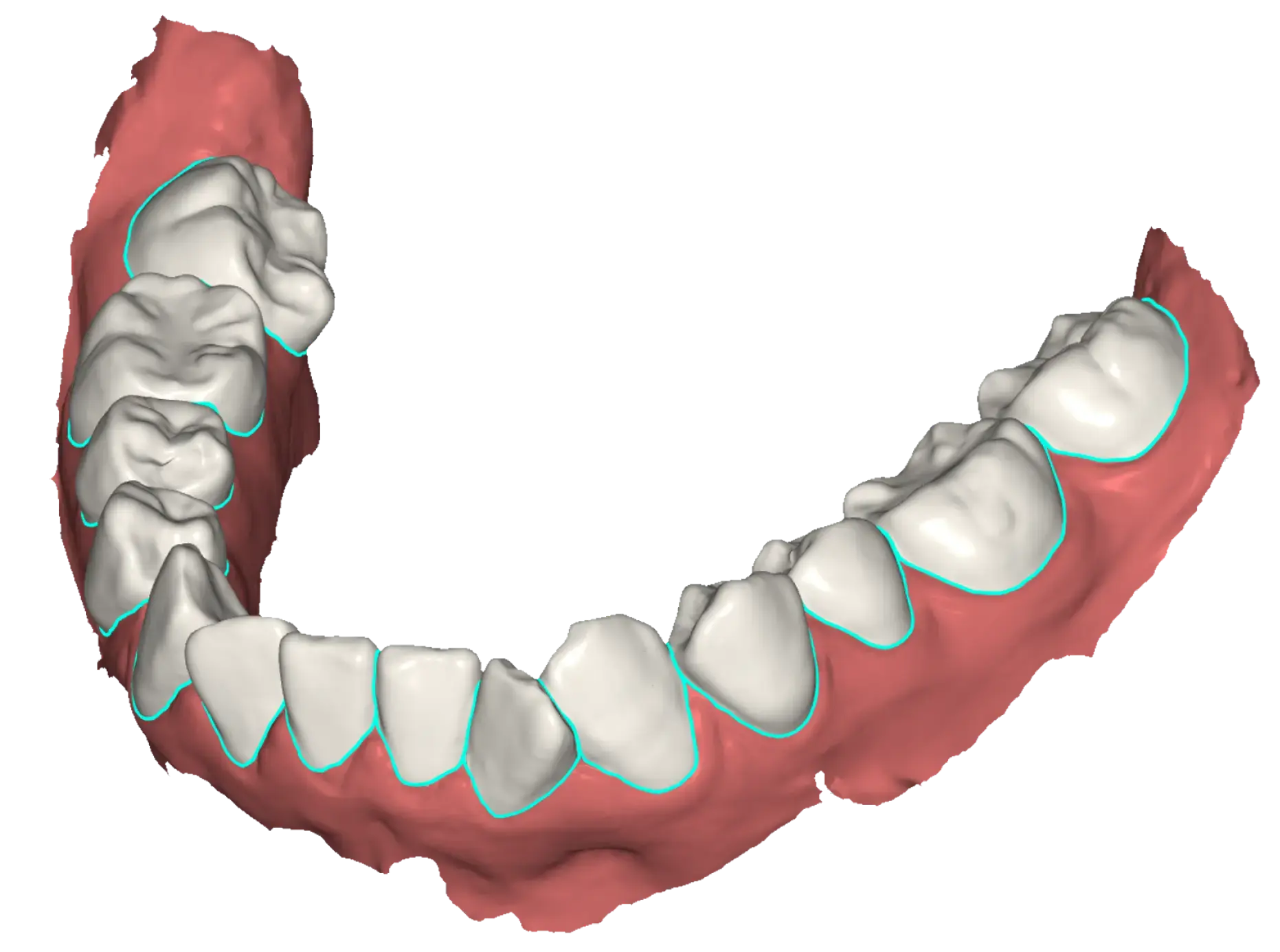 Scanned teeth data with highlighted mint blue line around each tooth