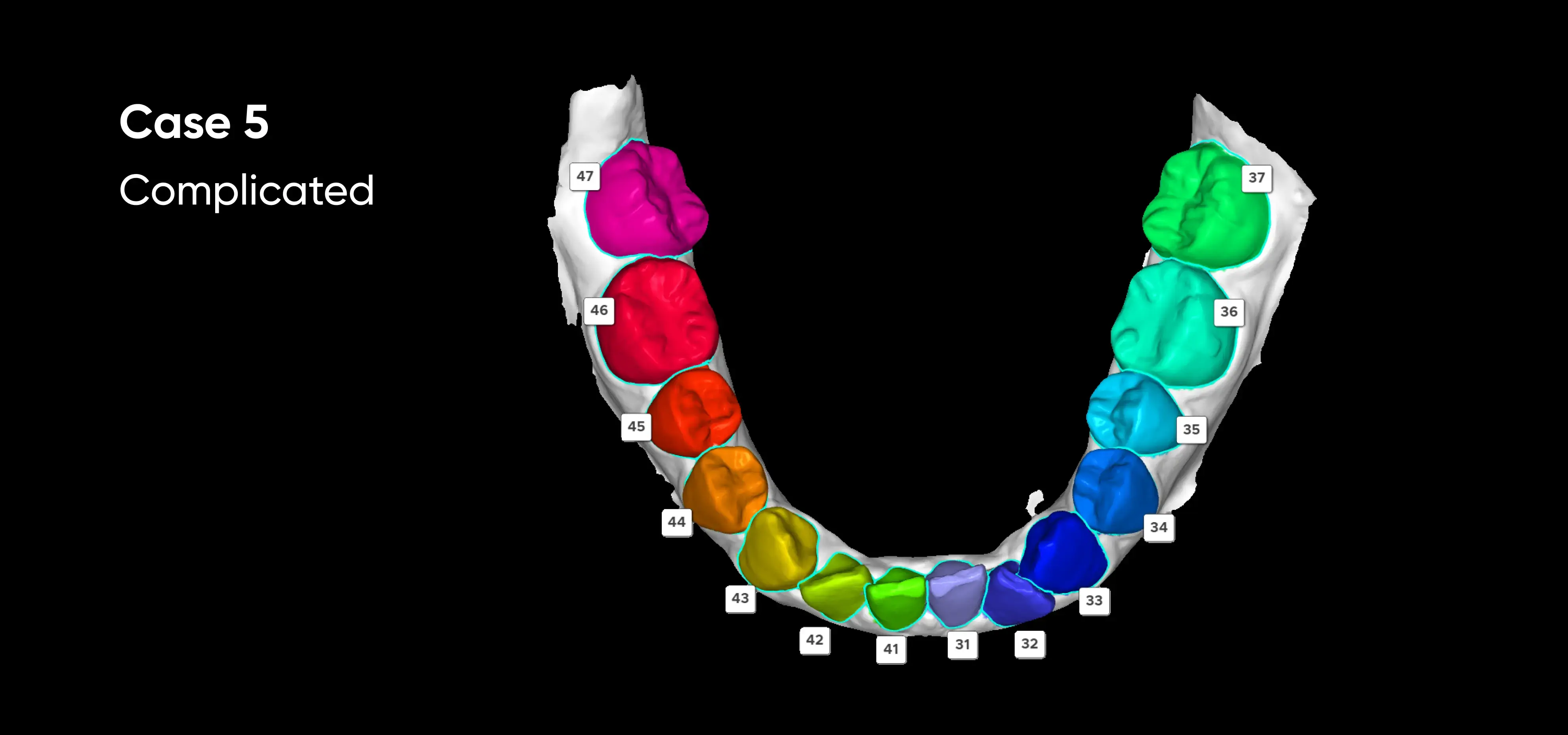 Case 5 lower teeth scan with every tooth in different color and number ...