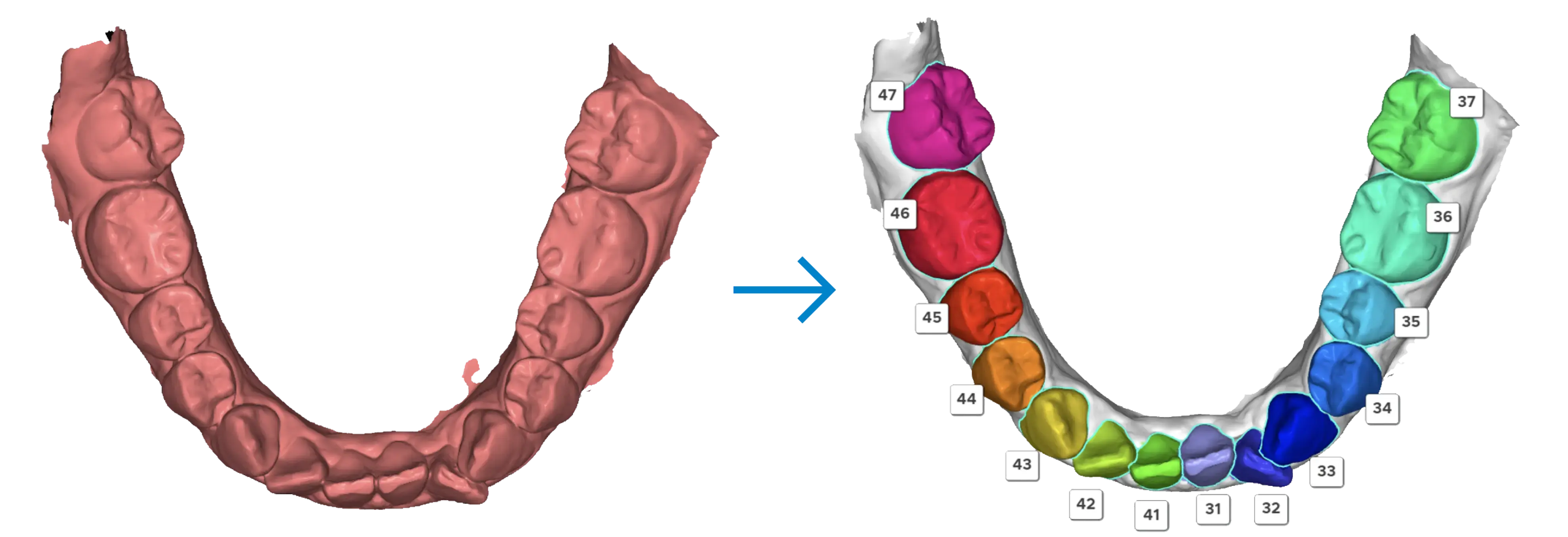 Scanned teeth data in pink color, arrow, the individual tooth of the data all in different ...